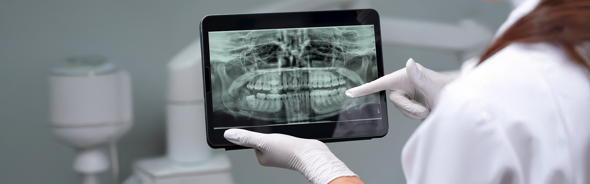 From X-Rays to Aligner Progression: A Step-by-Step Look at the ...